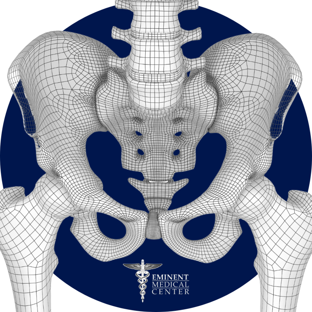 SI Joint Fusion in Richardson | Eminent Medical Center