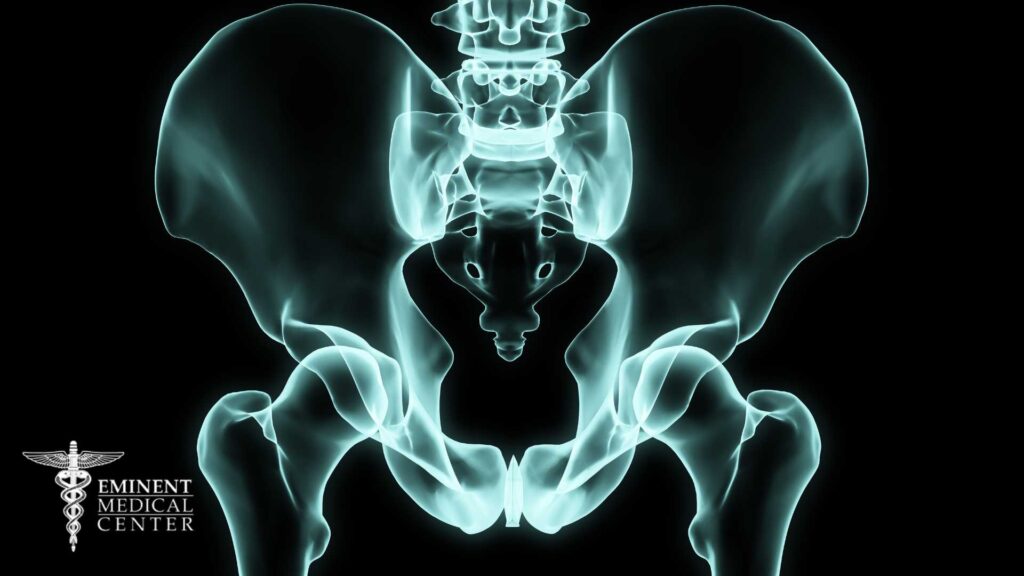 Dallas and Richardson Periacetabular Osteotomy (PAO)