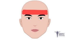 Head Pain Diagram | Types of Headaches and Headache Locations